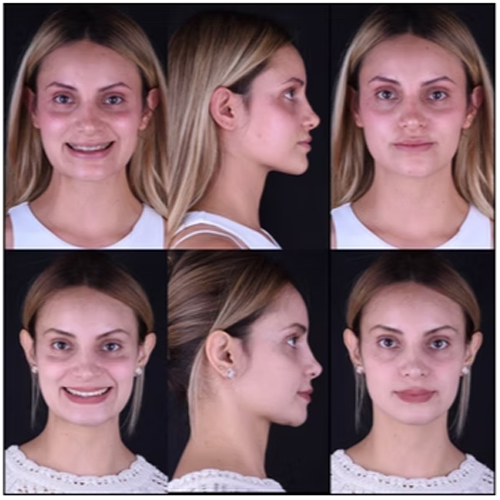 Ortodoncia | Dr Daniel Vainer | Costa Rica